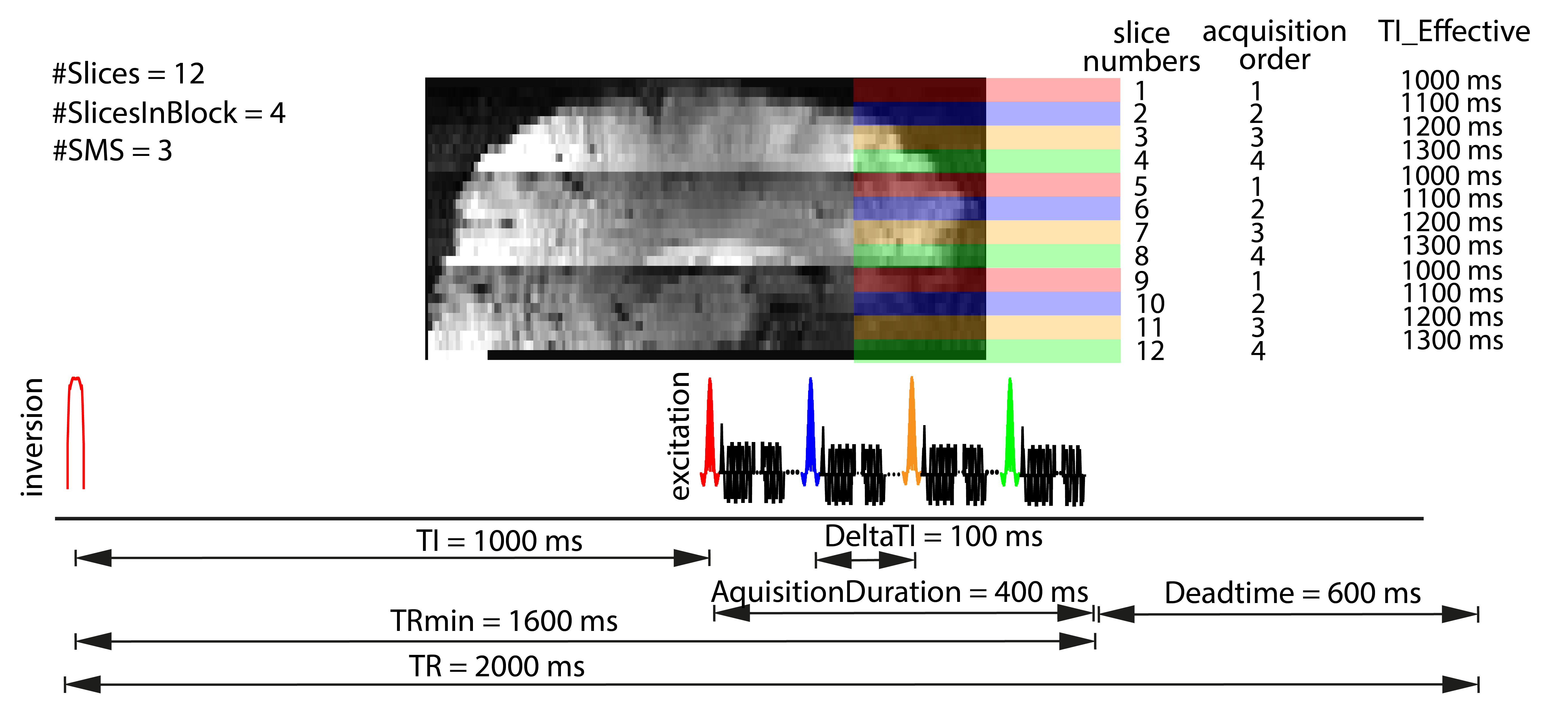 layer fMRI blog