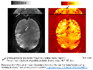 How to deal with Ghosts in high-res EPI – layer fMRI blog