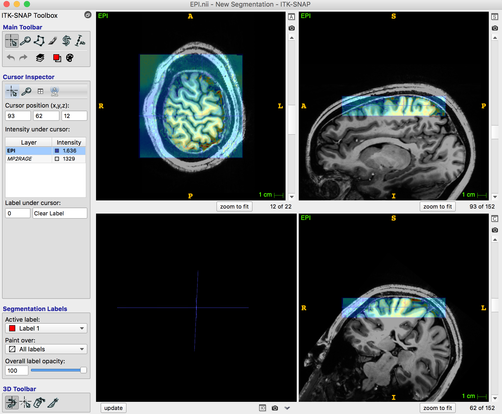 Registration of high-resolution data – layer fMRI blog
