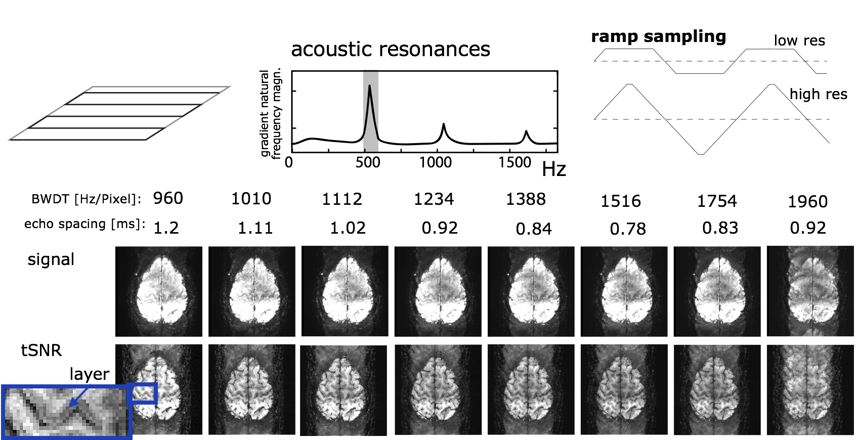 How to deal with Ghosts in high-res EPI – layer fMRI blog
