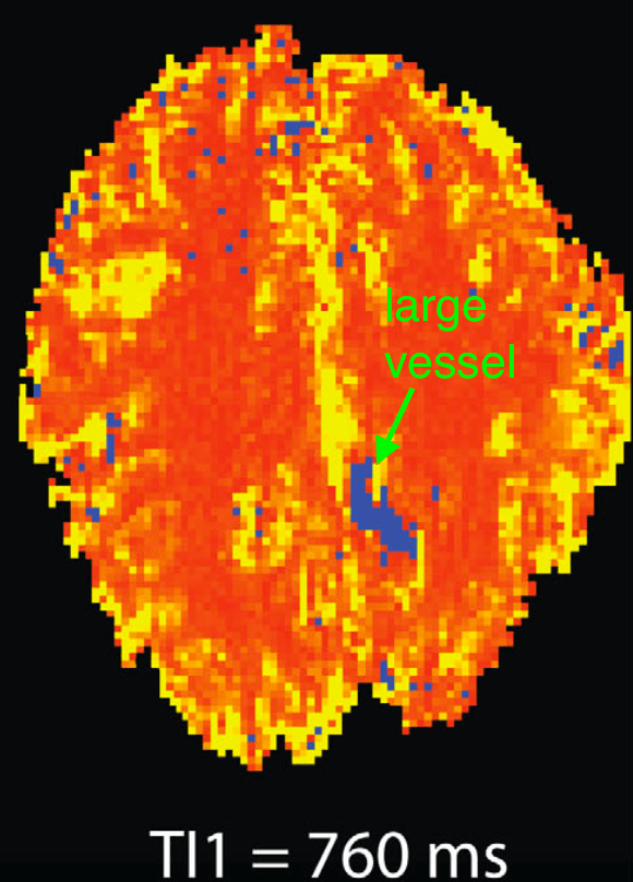 SS-SI-VASO Sequence Manual – layer fMRI blog