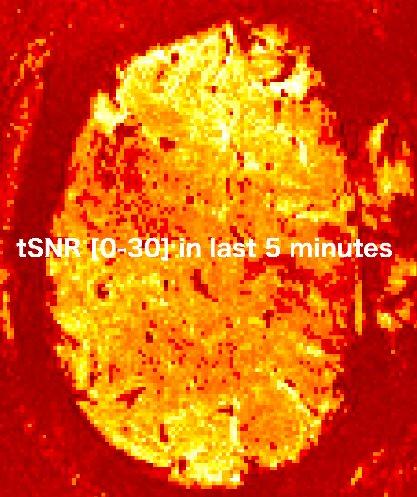 3_gif_annotated – layer fMRI blog