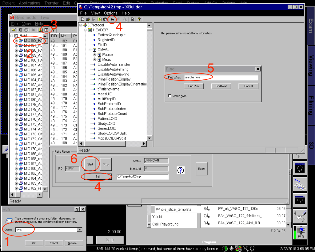 Unwanted spatial blurring during resampling – layer fMRI blog