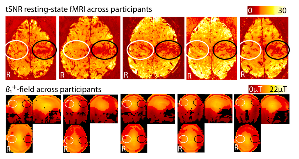 Finding ROI of the double layers in M1 – layer fMRI blog
