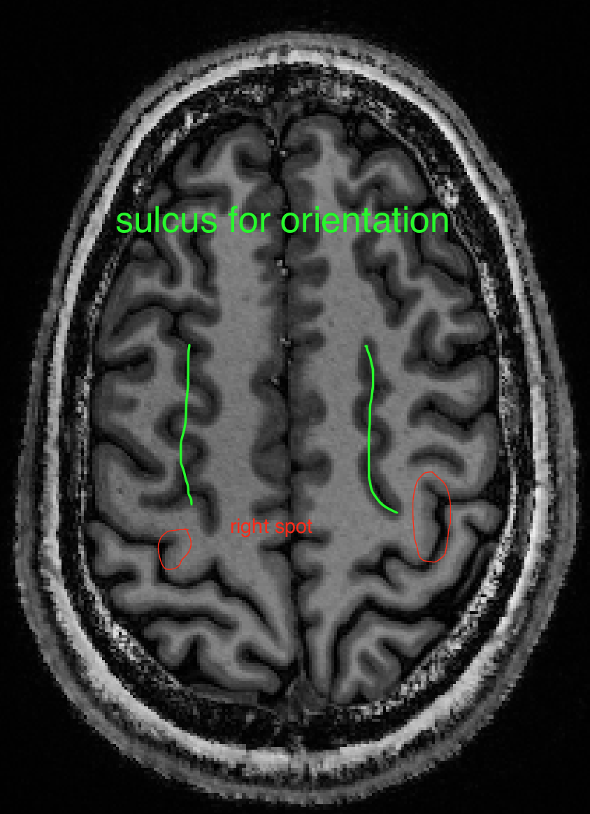 Finding ROI of the double layers in M1 – layer fMRI blog
