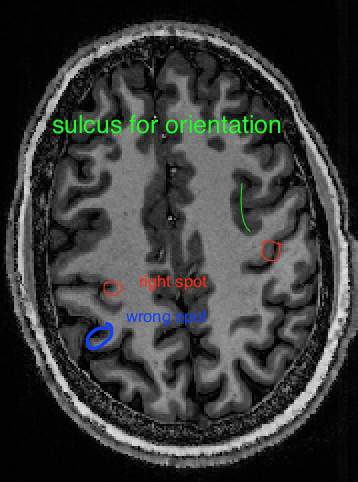 Finding ROI of the double layers in M1 – layer fMRI blog