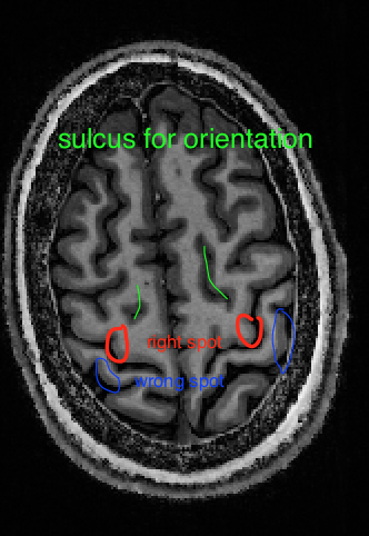 Finding ROI of the double layers in M1 – layer fMRI blog