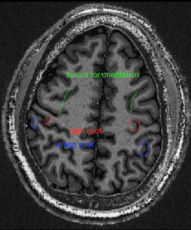 Finding ROI of the double layers in M1 – layer fMRI blog