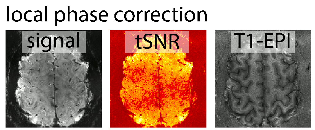 EPI phase correction algorithms – layer fMRI blog