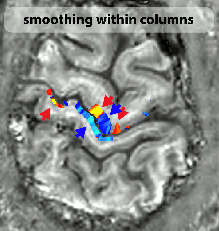 Anatomically informed spatial smoothing – layer fMRI blog