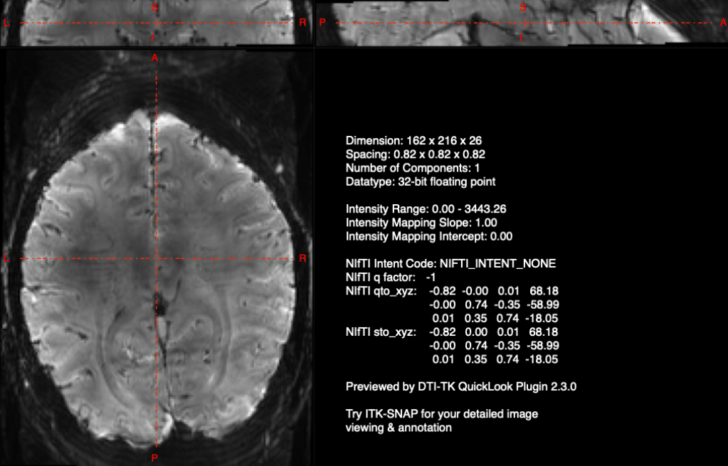Intensity projections in LAYNII – layer fMRI blog