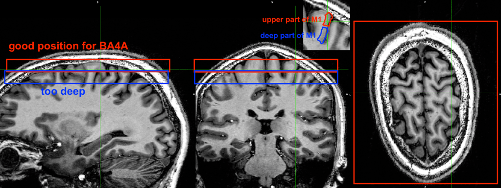 Finding ROI of the double layers in M1 – layer fMRI blog