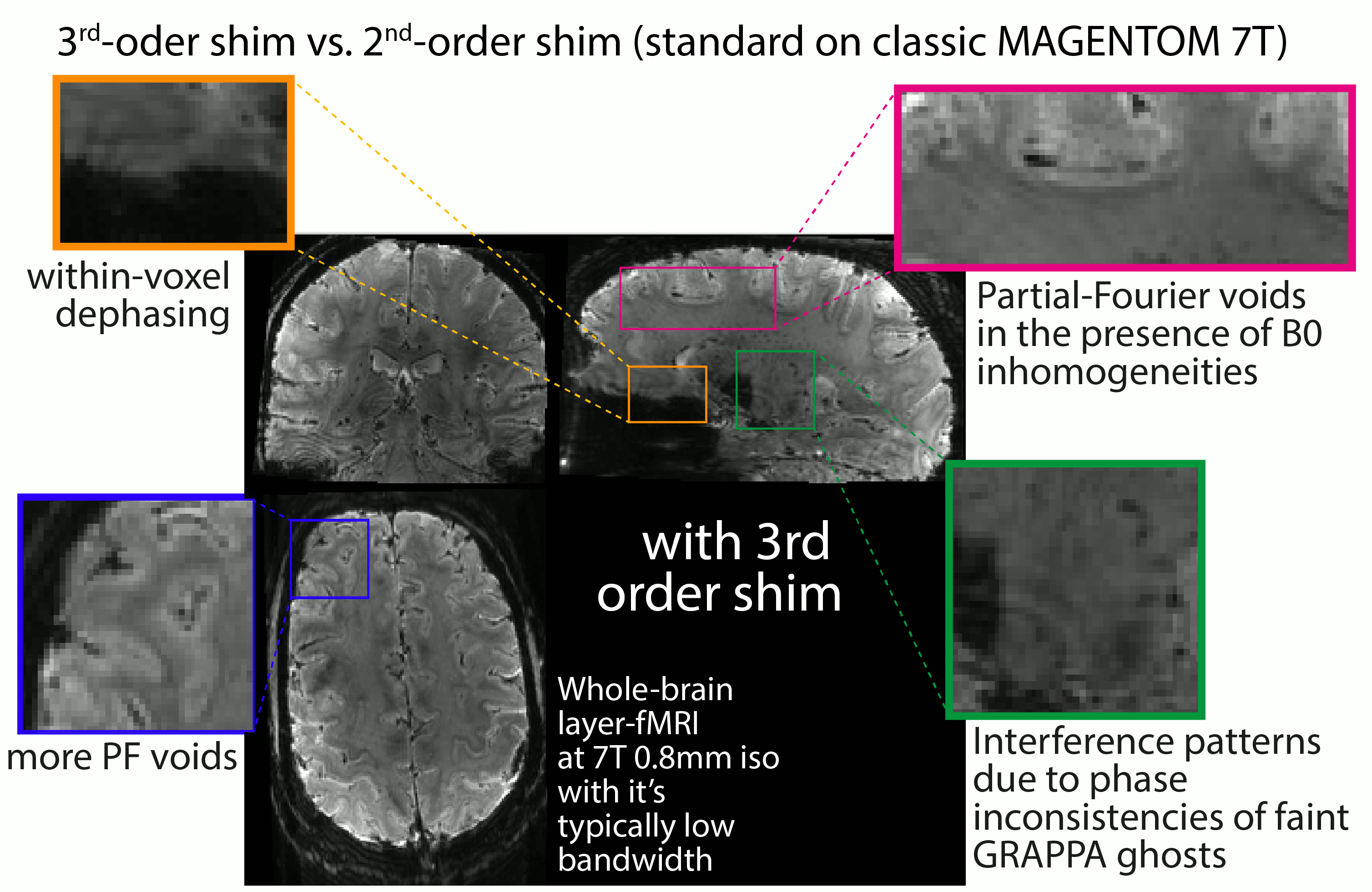 3rd order shim for layer-fMRI: To get best data quality, avoid certain ...