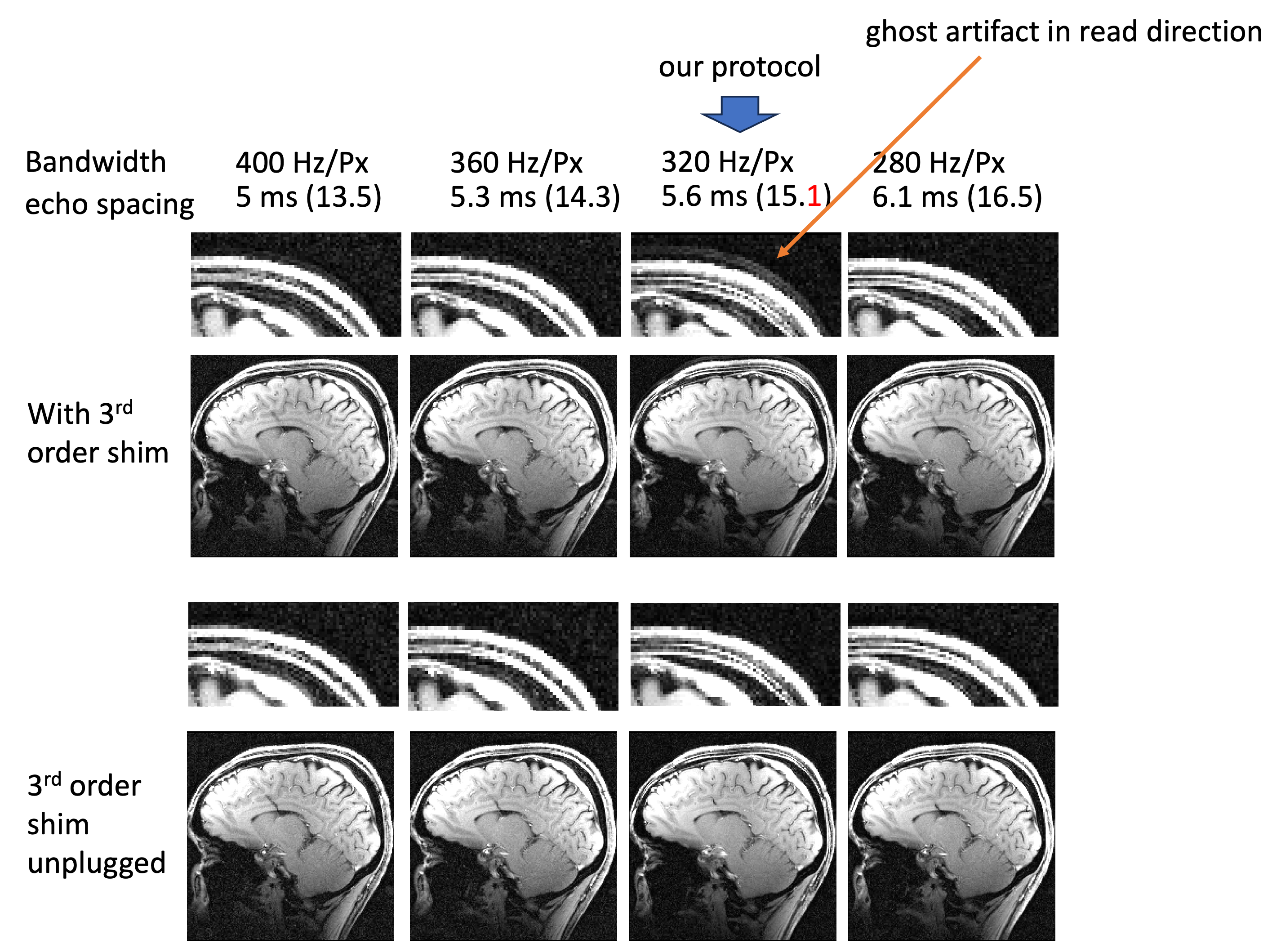 3rd order shim for layer-fMRI: To get best data quality, avoid certain ...