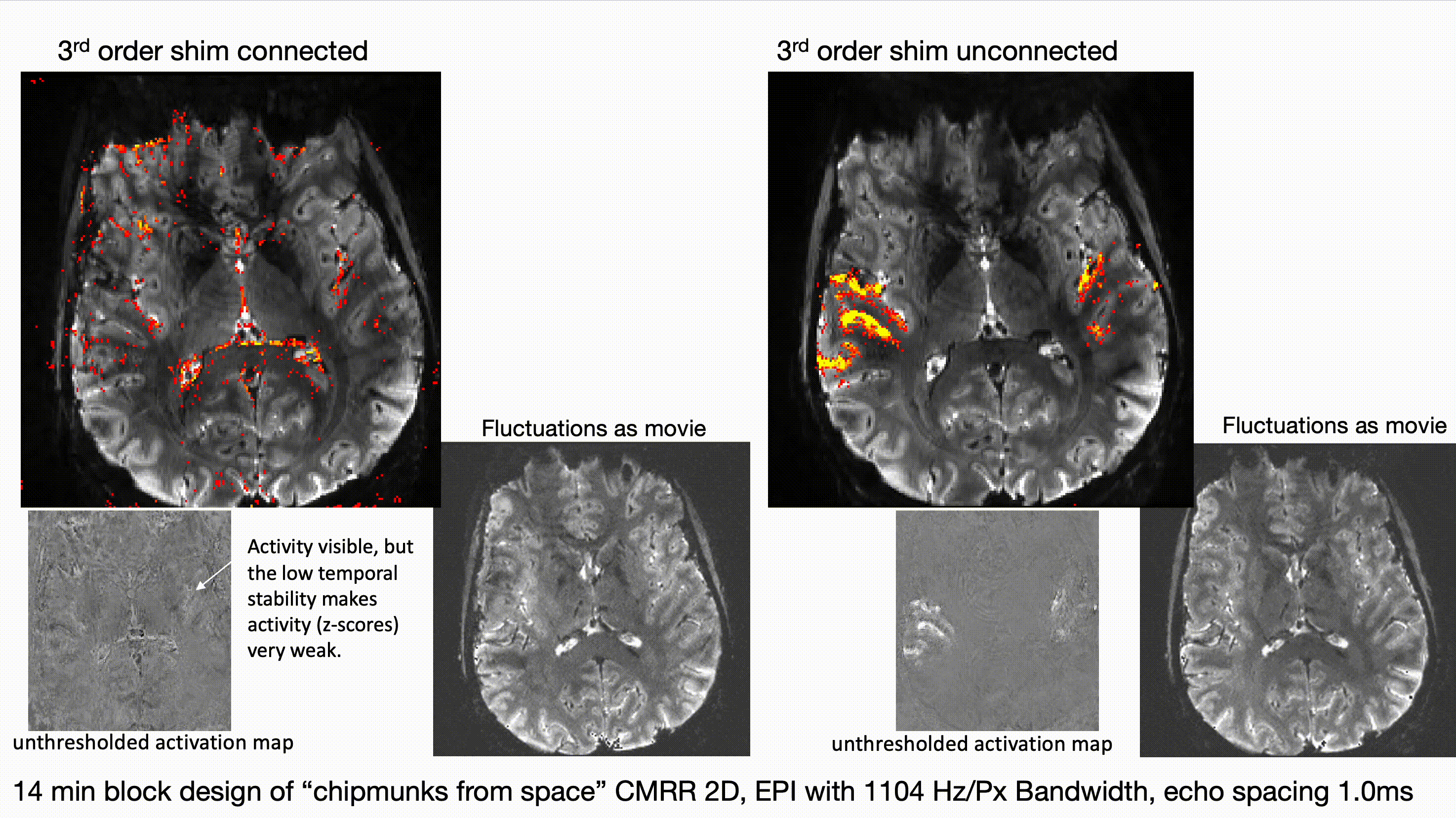 3rd order shim for layer-fMRI: To get best data quality, avoid certain ...