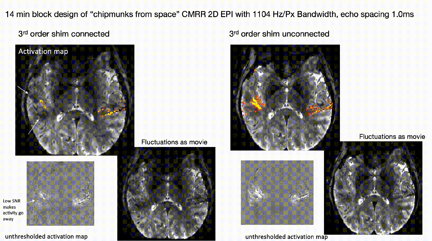3rd order shim for layer-fMRI: To get best data quality, avoid certain ...