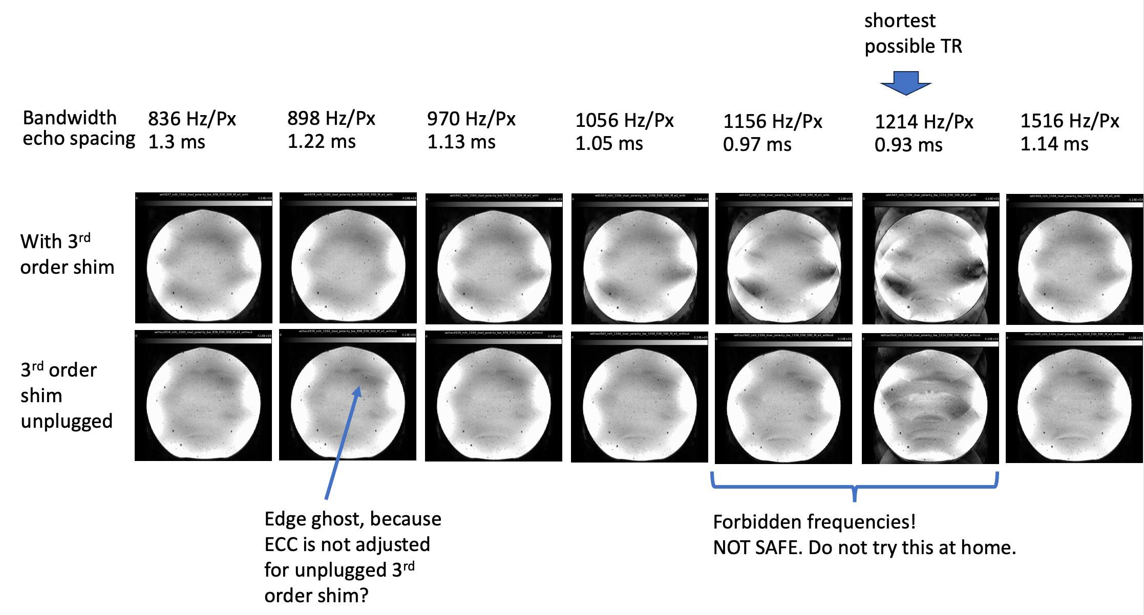 3rd order shim for layer-fMRI: To get best data quality, avoid certain ...