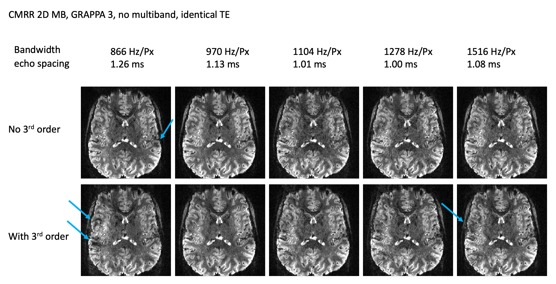 3rd order shim for layer-fMRI: To get best data quality, avoid certain ...