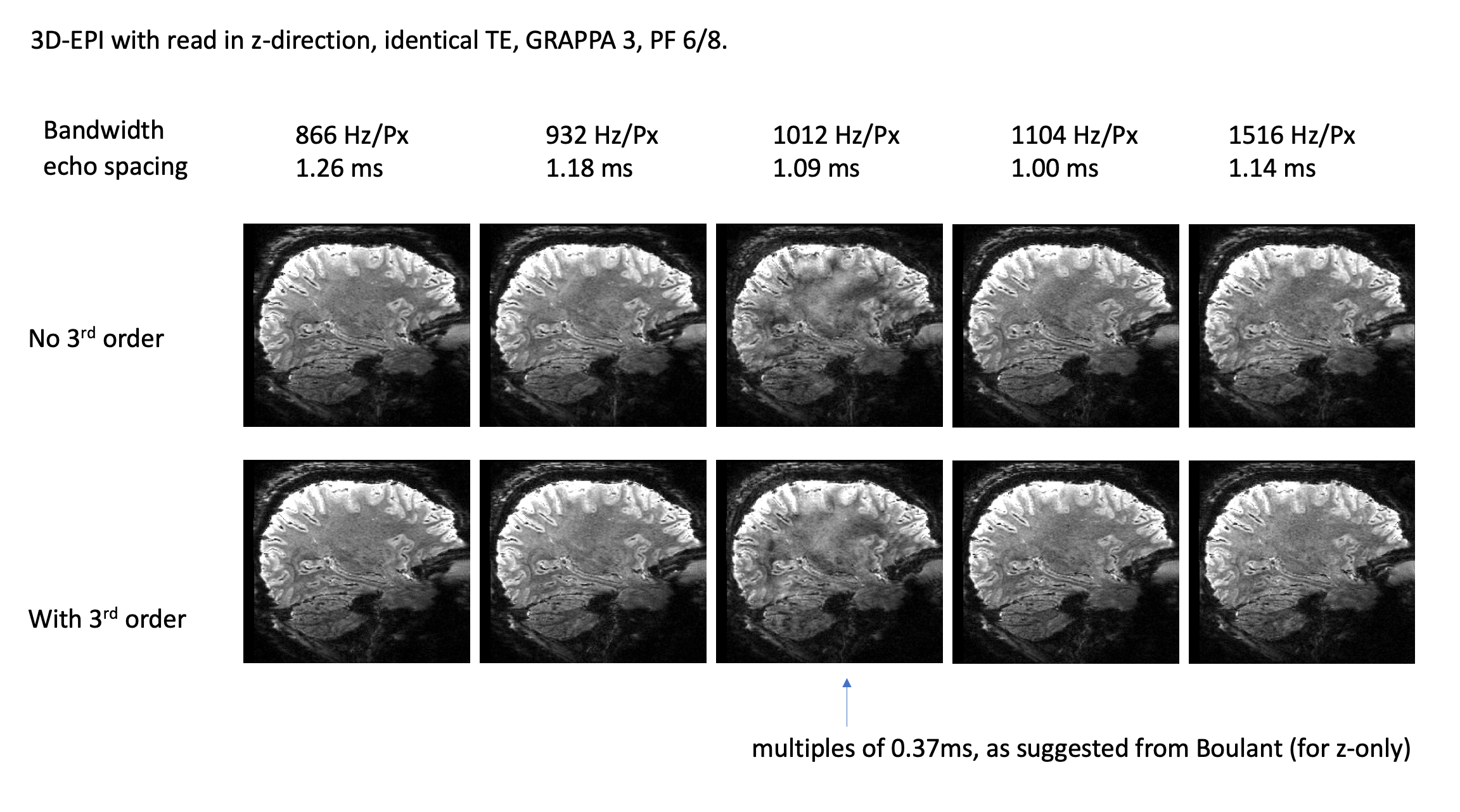 3rd order shim for layer-fMRI: To get best data quality, avoid certain ...