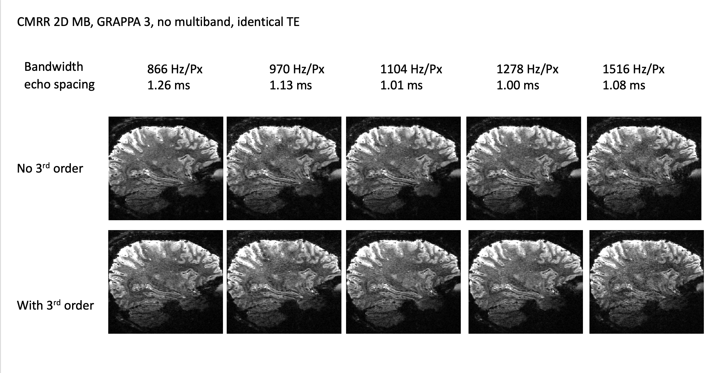 3rd order shim for layer-fMRI: To get best data quality, avoid certain ...